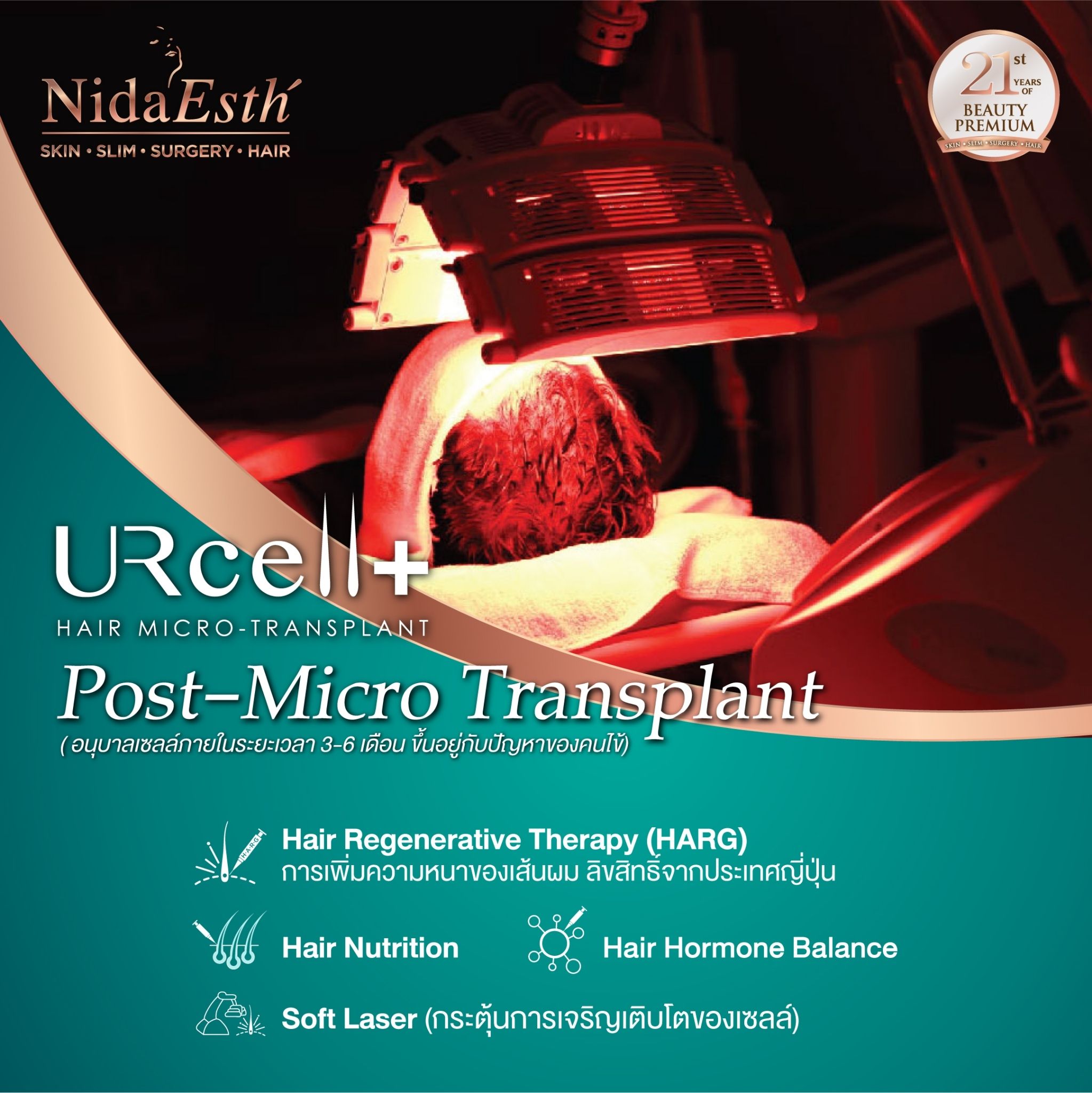 ปลูกผมด้วยเซลล์คุณเอง UR Cell Hair Micro Transplant+ เทคนิคใหม่!